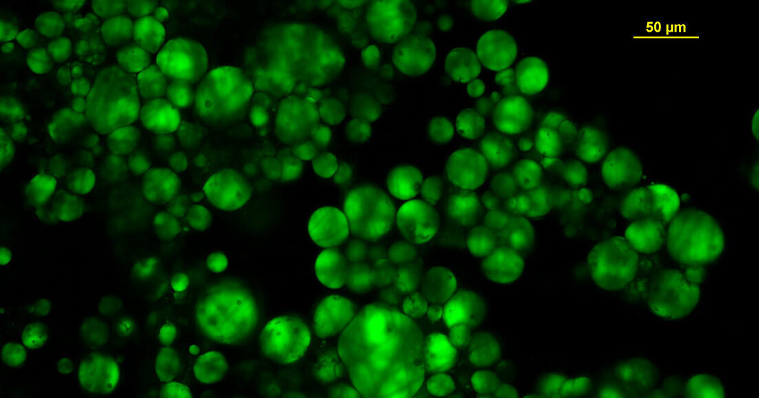 Obatala Sciences Announces Commercial Launch of Its ObaCell®…